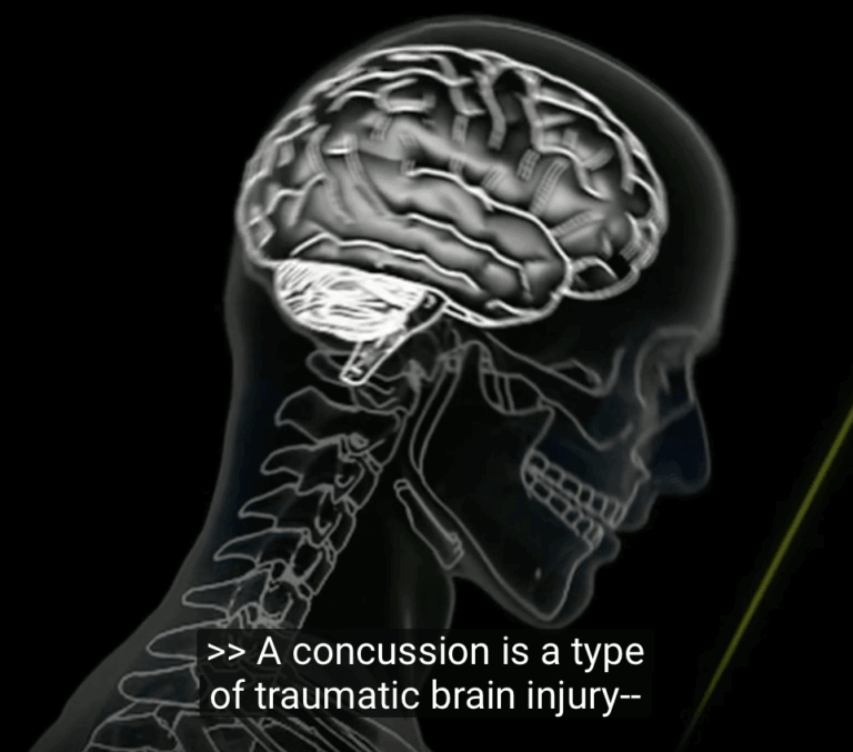 What Is A Concussion? - The Whole Psychiatry & Brain Recovery Center